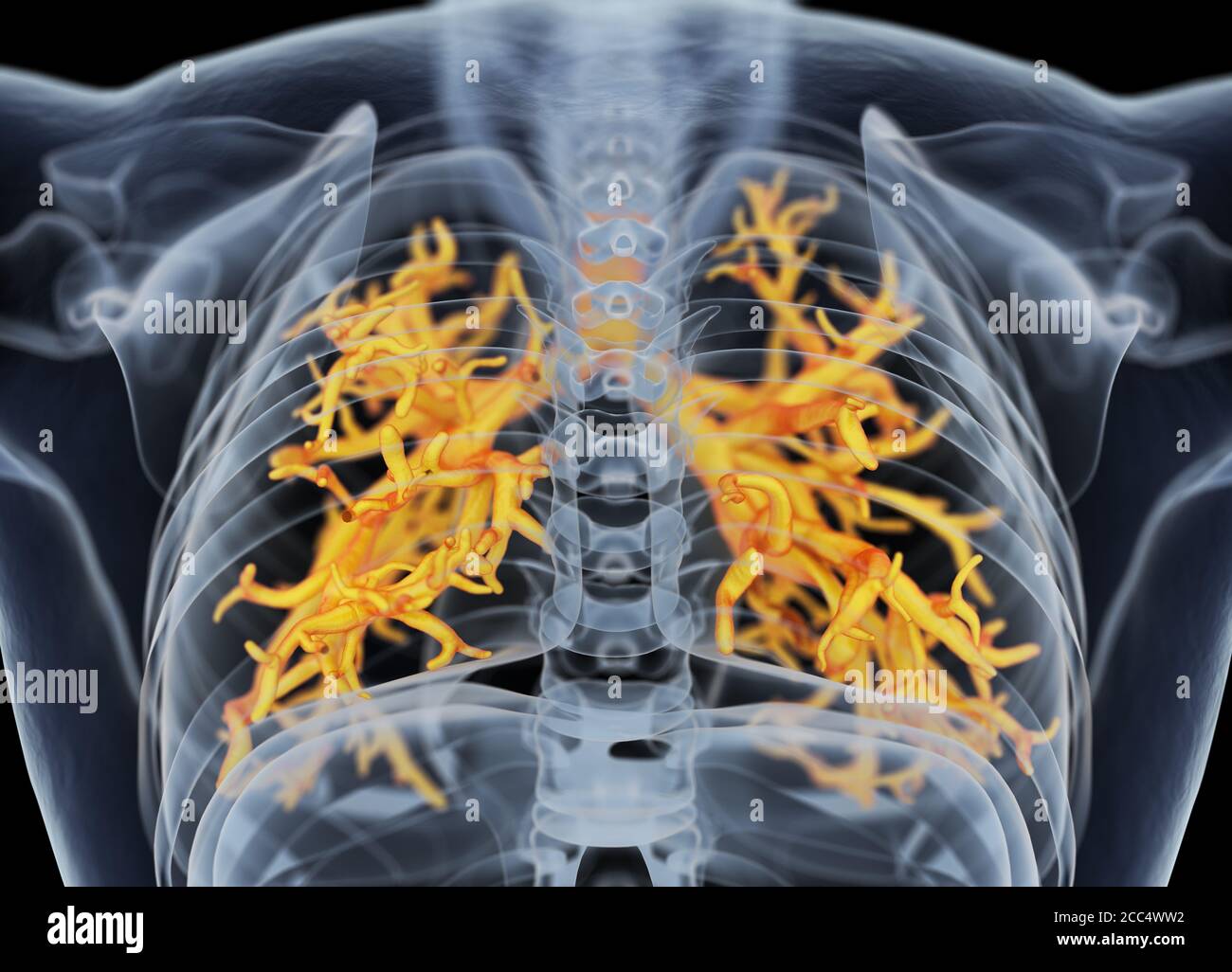 Anatomy illustration of human bronchi and trachea. 3d illustration ...
