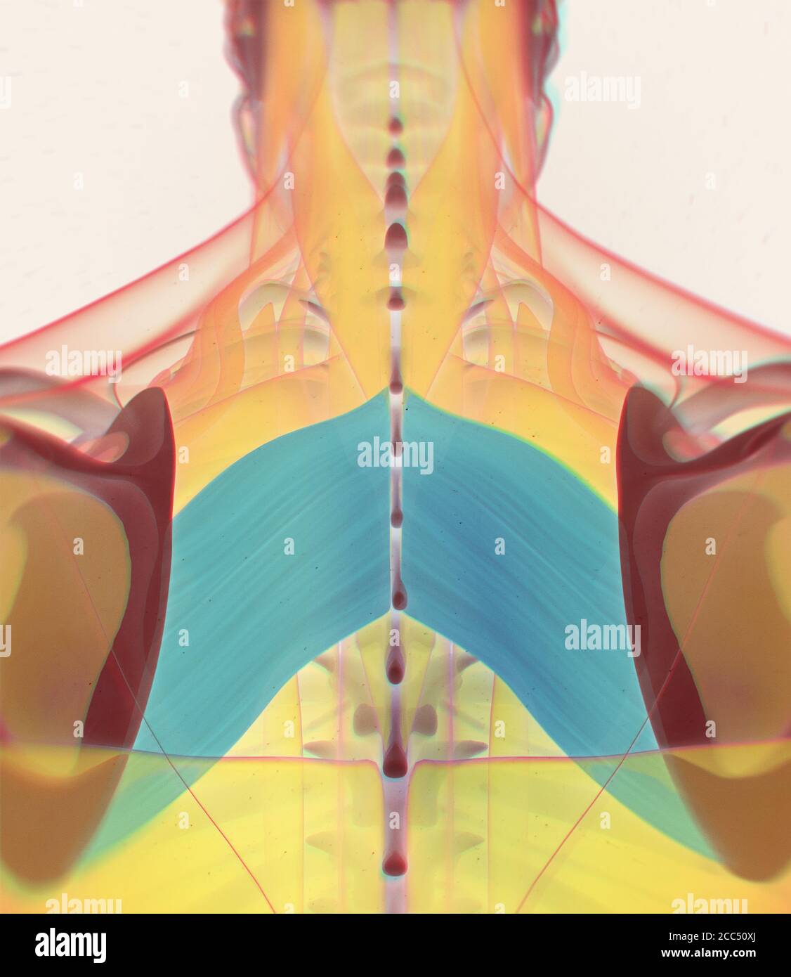 Anatomy illustration of Rhomboid Major.Human muscle body xray scan. 3D ...