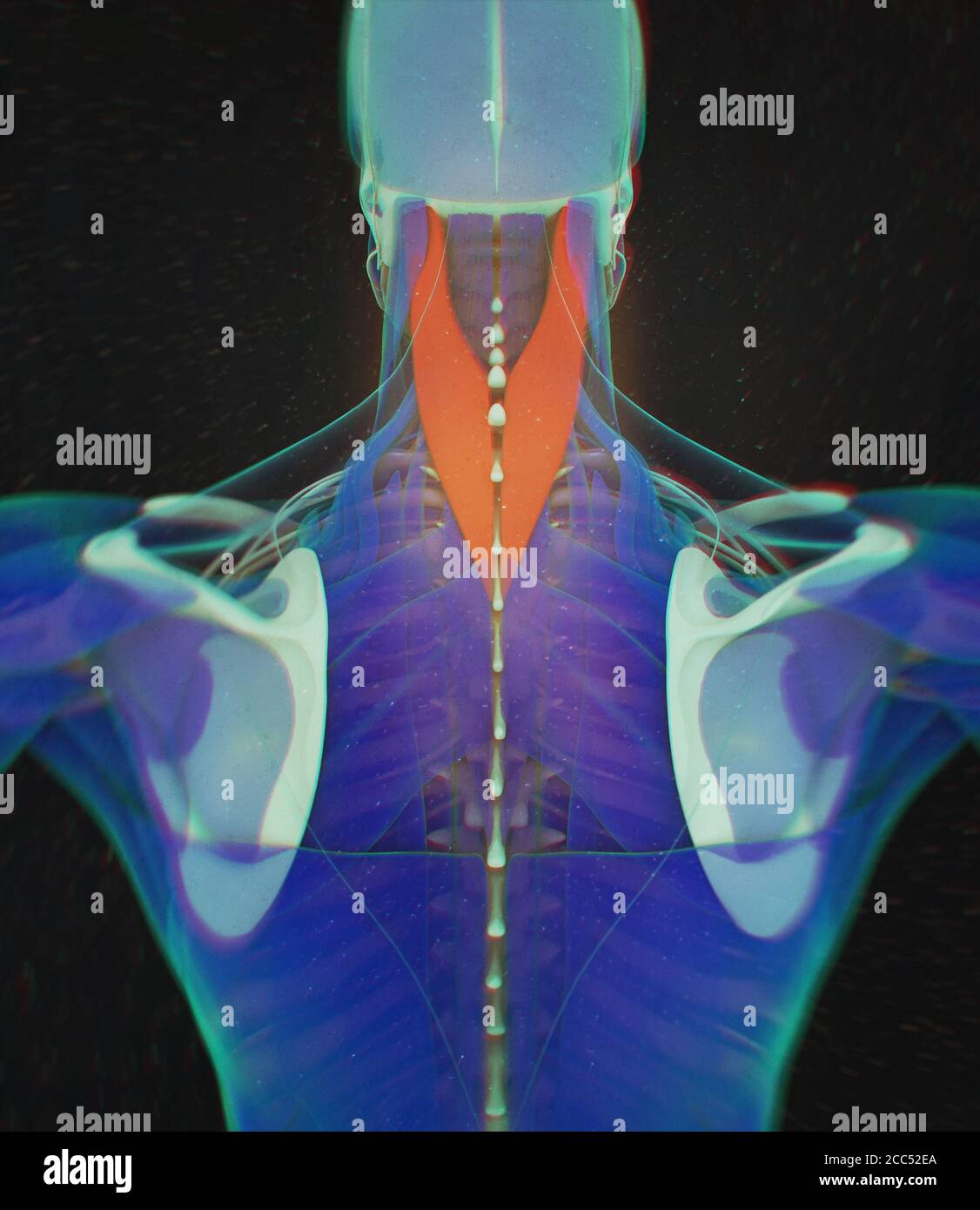 Splenius Capitis, neck muscles, stress, human anatomy. 3D illustration ...