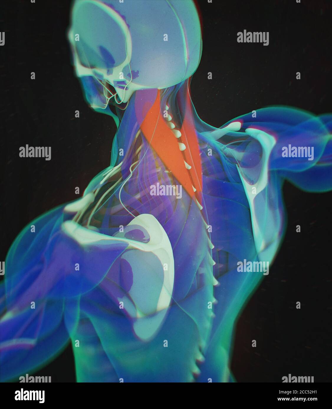 Splenius muscle hi-res stock photography and images - Alamy