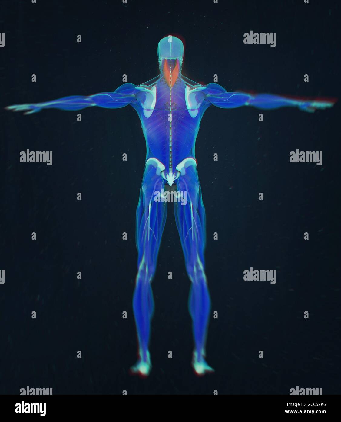 Splenius Cervicis Cadaver
