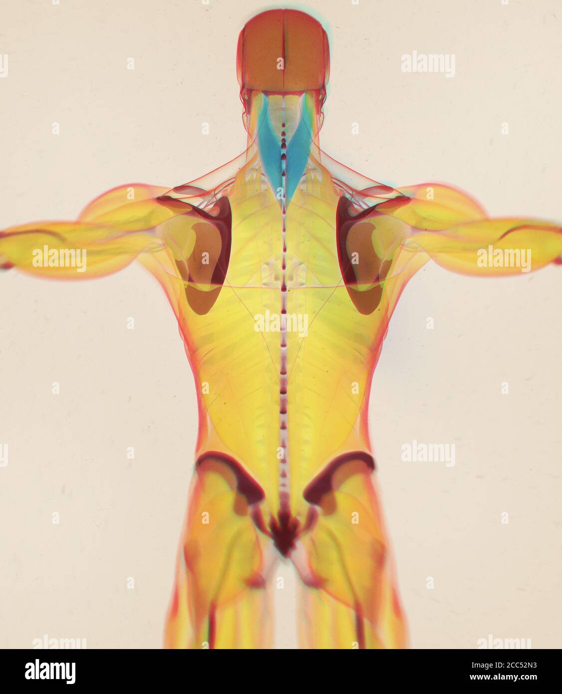 Splenius Capitis, neck muscles, stress, human anatomy. 3D illustration ...