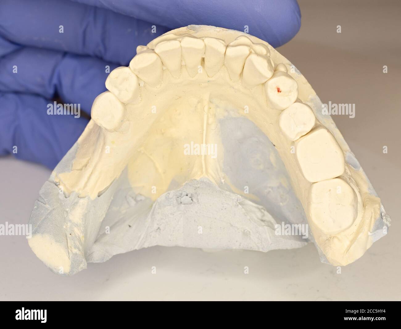Upper body plaster cast hi-res stock photography and images - Alamy