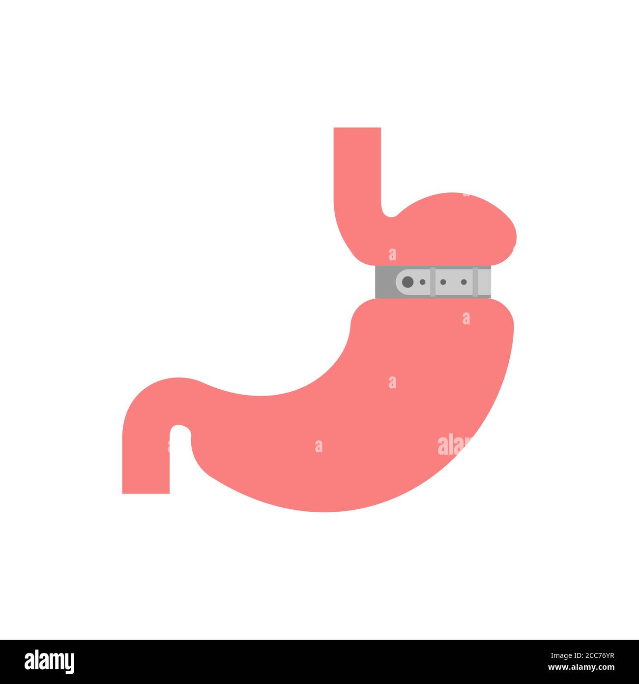 Laparoscopic adjustable banding Stock Vector Images - Alamy