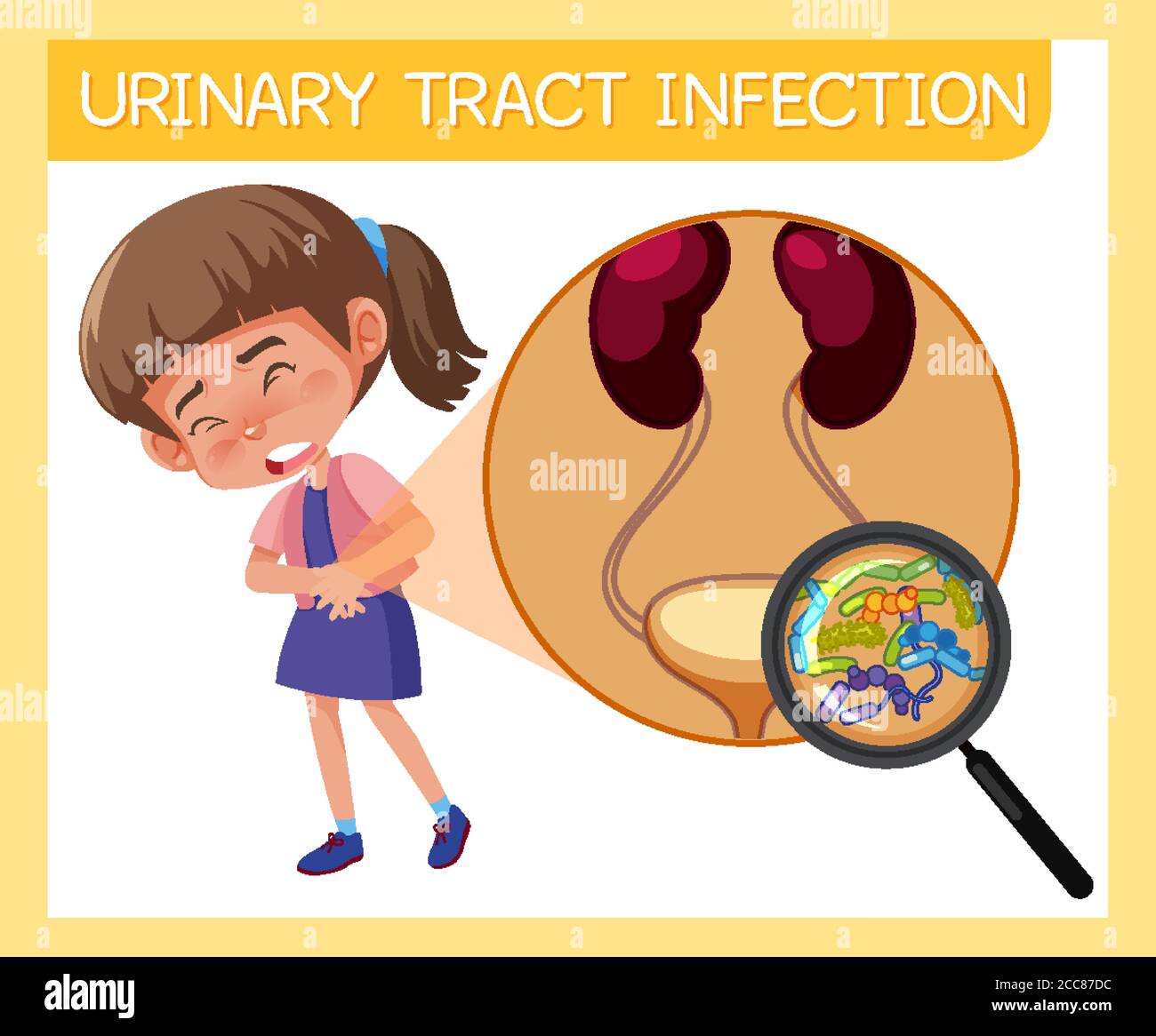 Girl having urinary tract infection illustration Stock Vector Image ...