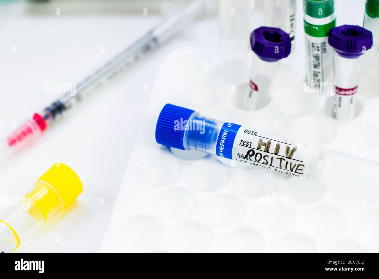 Hiv and aids infection test, doctors face and hand holding tube with ...