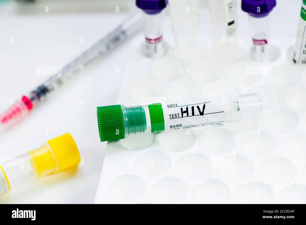 Hiv and aids infection test, doctors face and hand holding tube with ...