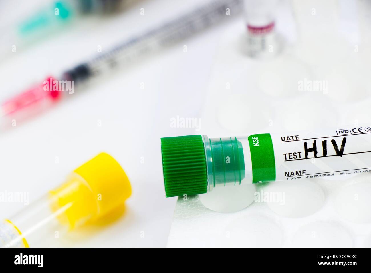 Hiv and aids infection test, doctors face and hand holding tube with ...