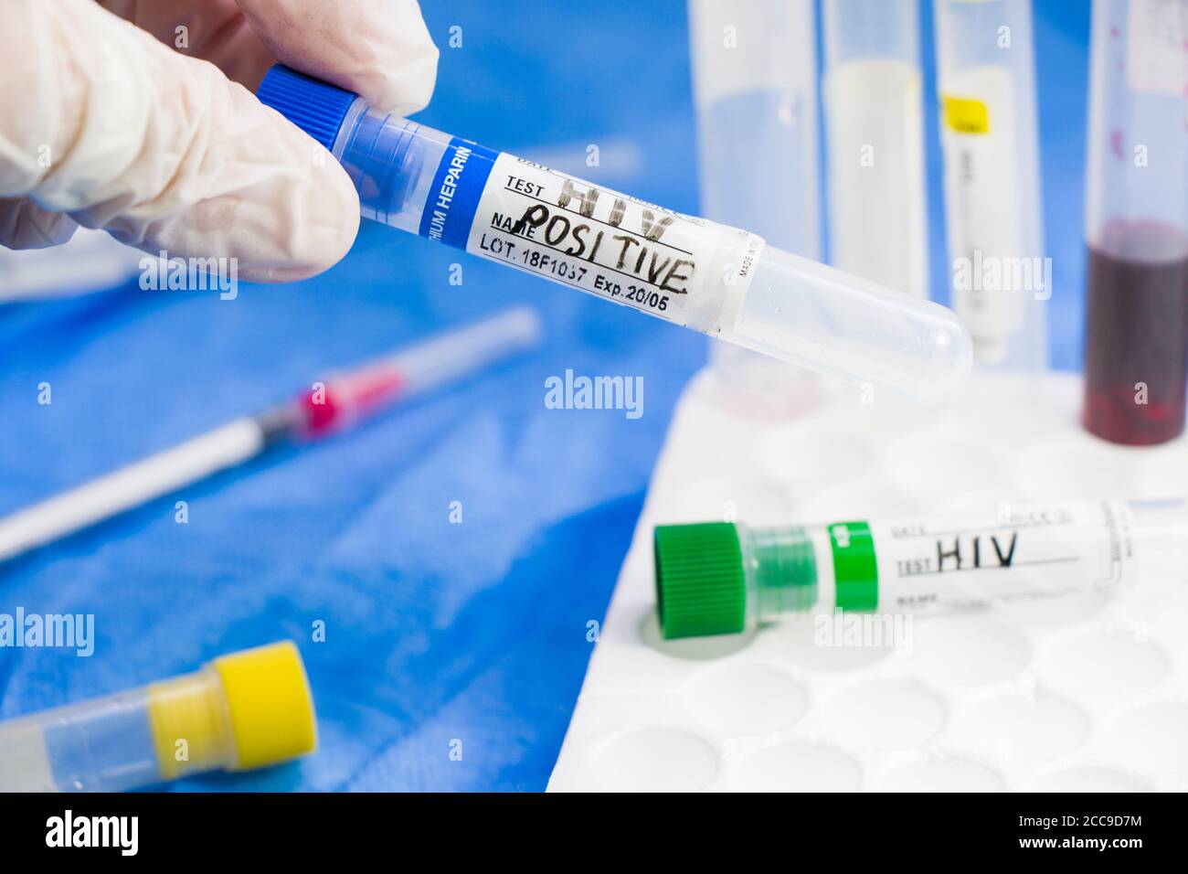 HIV and aids infection test, doctors face and hand holding tube with ...