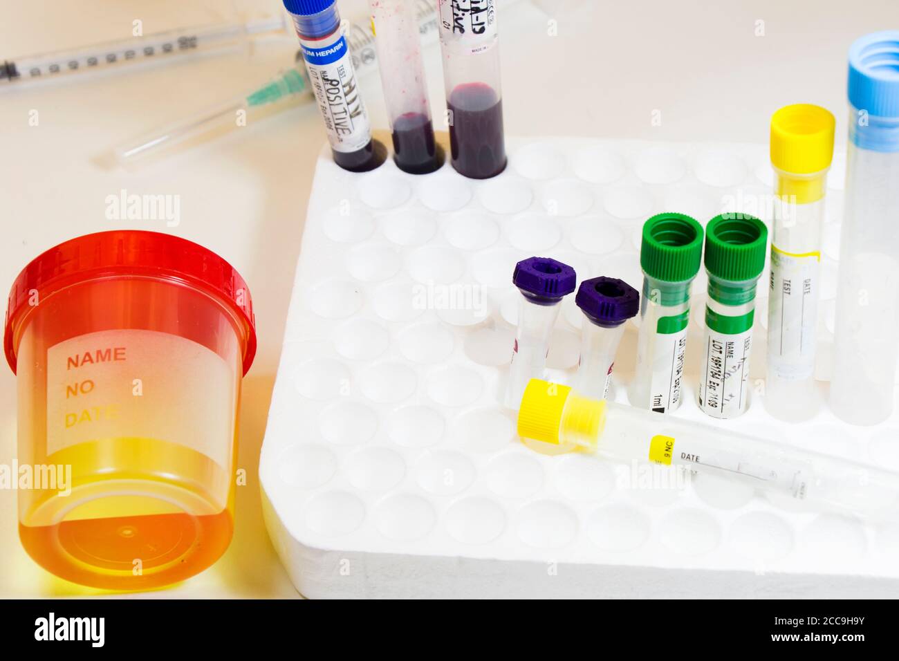 Drug test, medical urine and pee test with blood and other tubes on the ...