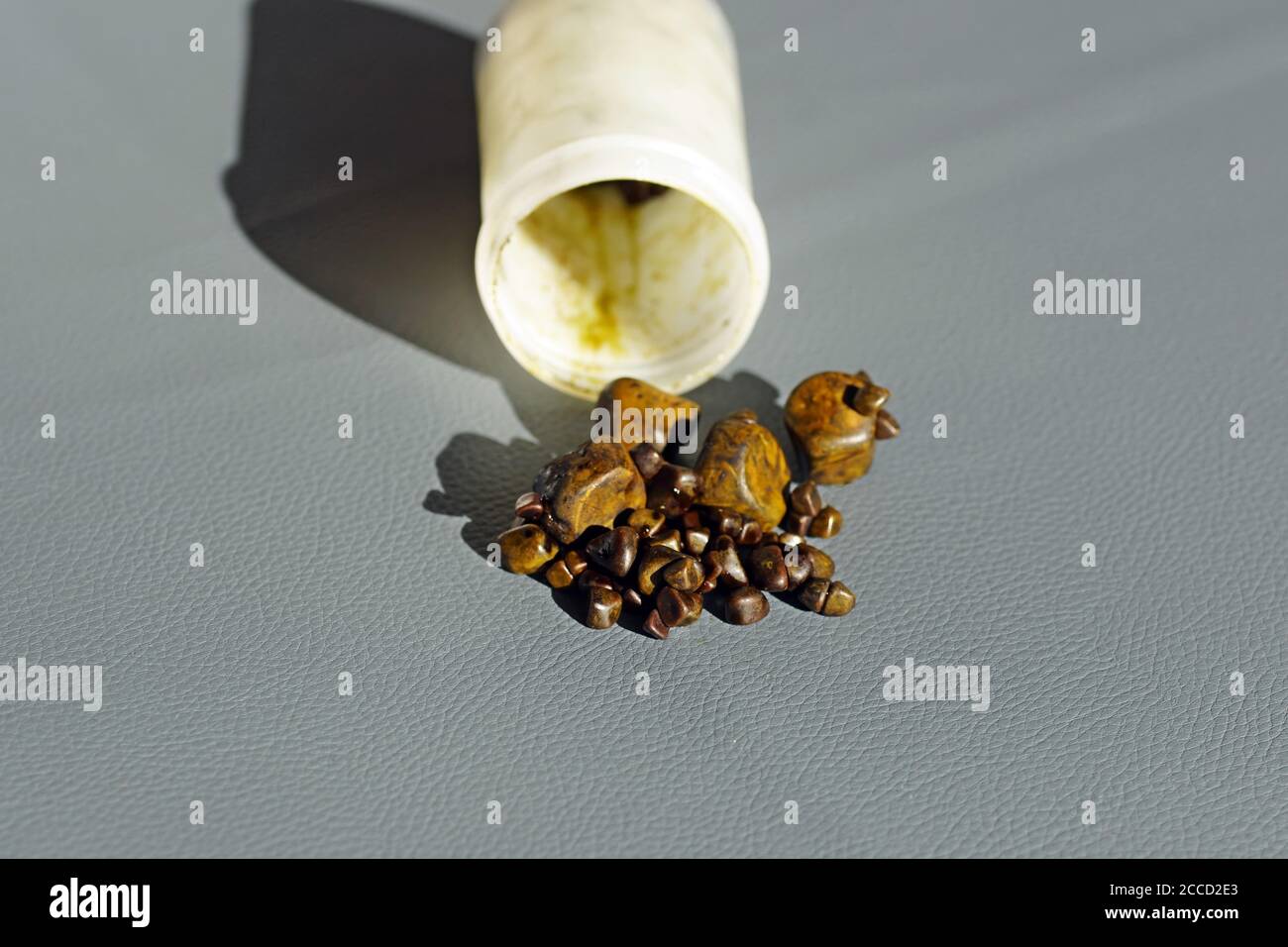 Gall stones hi-res stock photography and images - Alamy