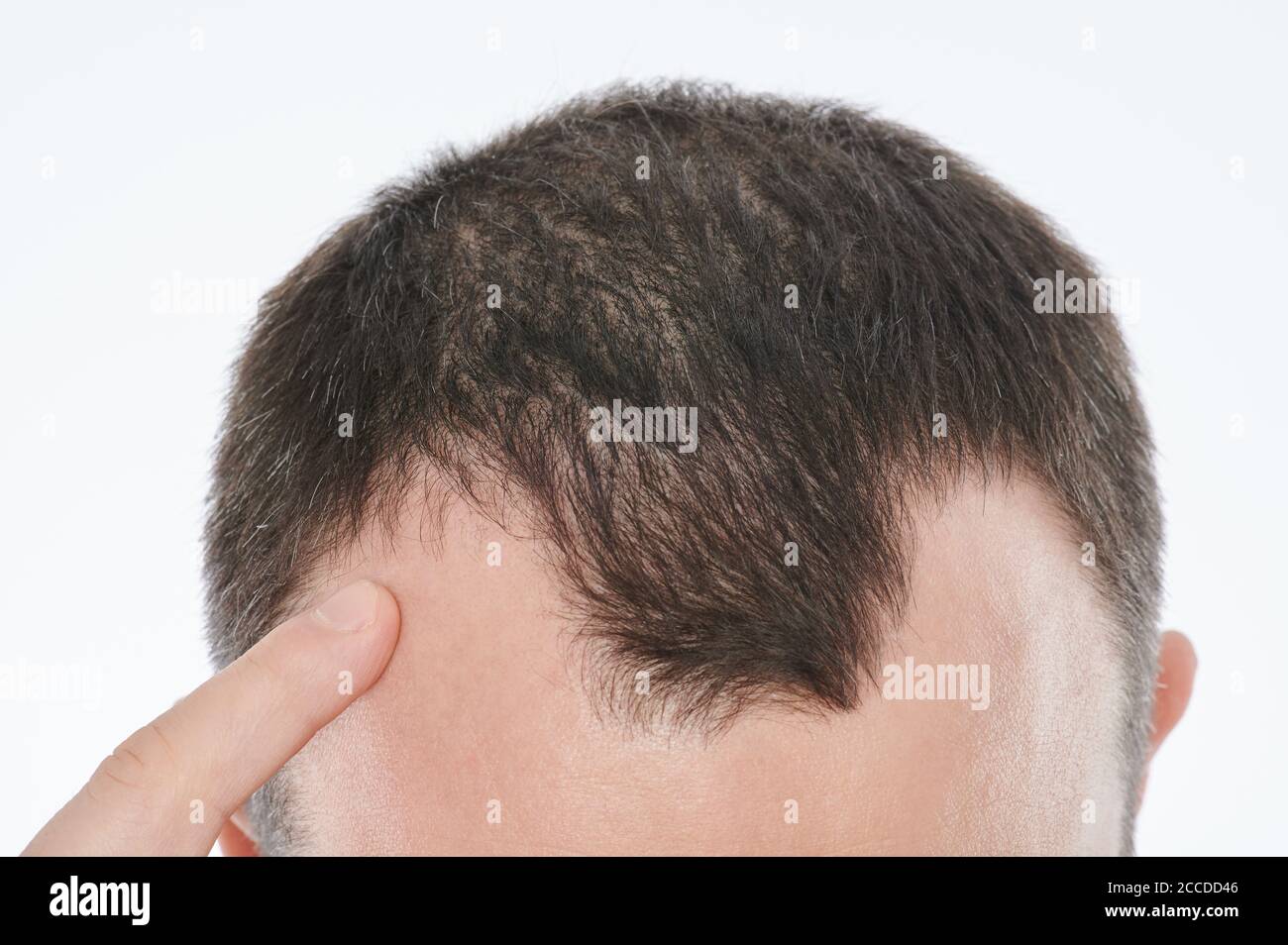 Man point to bold spot on head close up isolated in white background ...