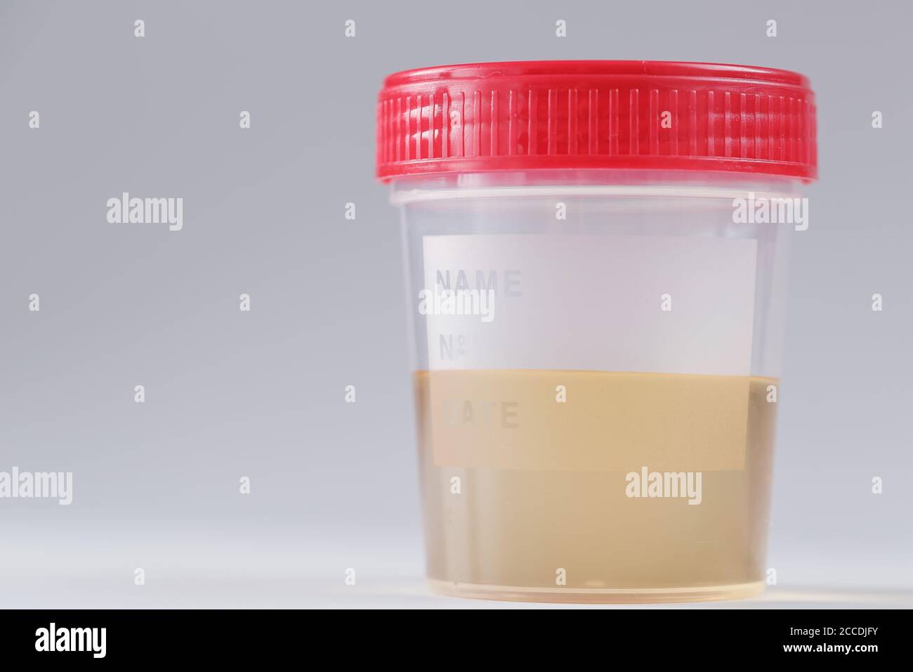 Plastic container with yellow urine analysis for detecting diseases ...