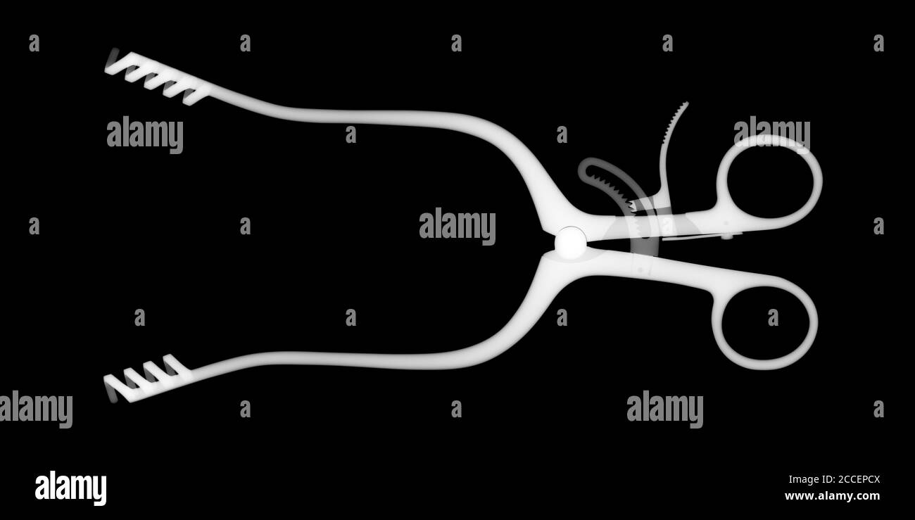 Medical forceps, X-ray Stock Photo - Alamy