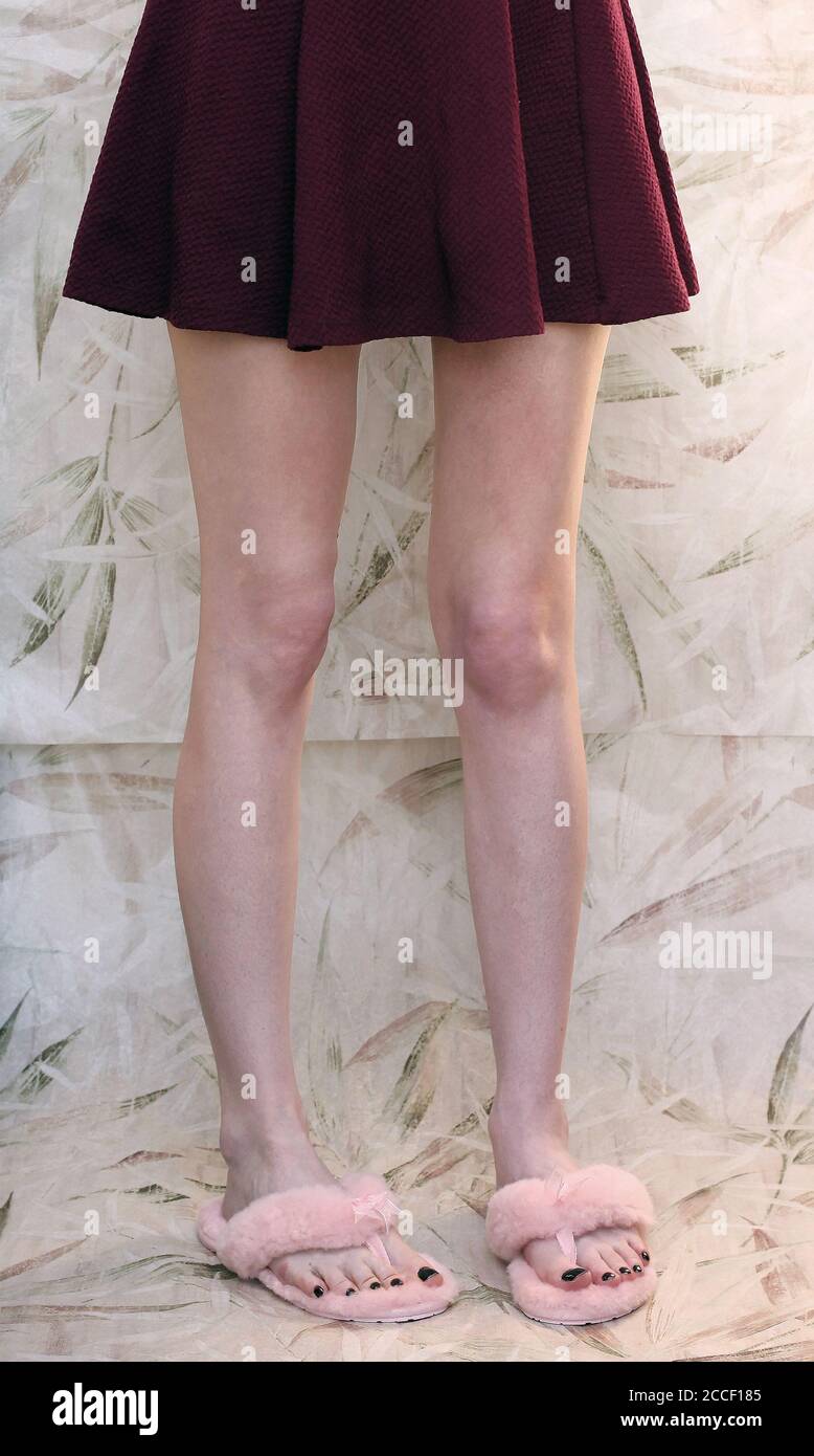Long female legs with short skirt in pink flip flops sandals Stock ...