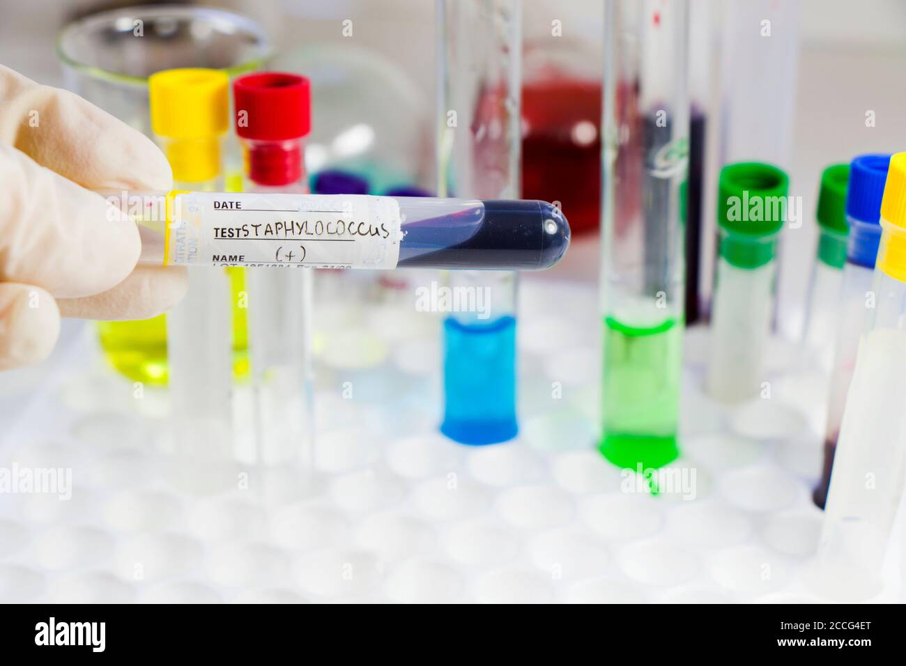 Staphylococci Bacteria High Resolution Stock Photography and Images - Alamy