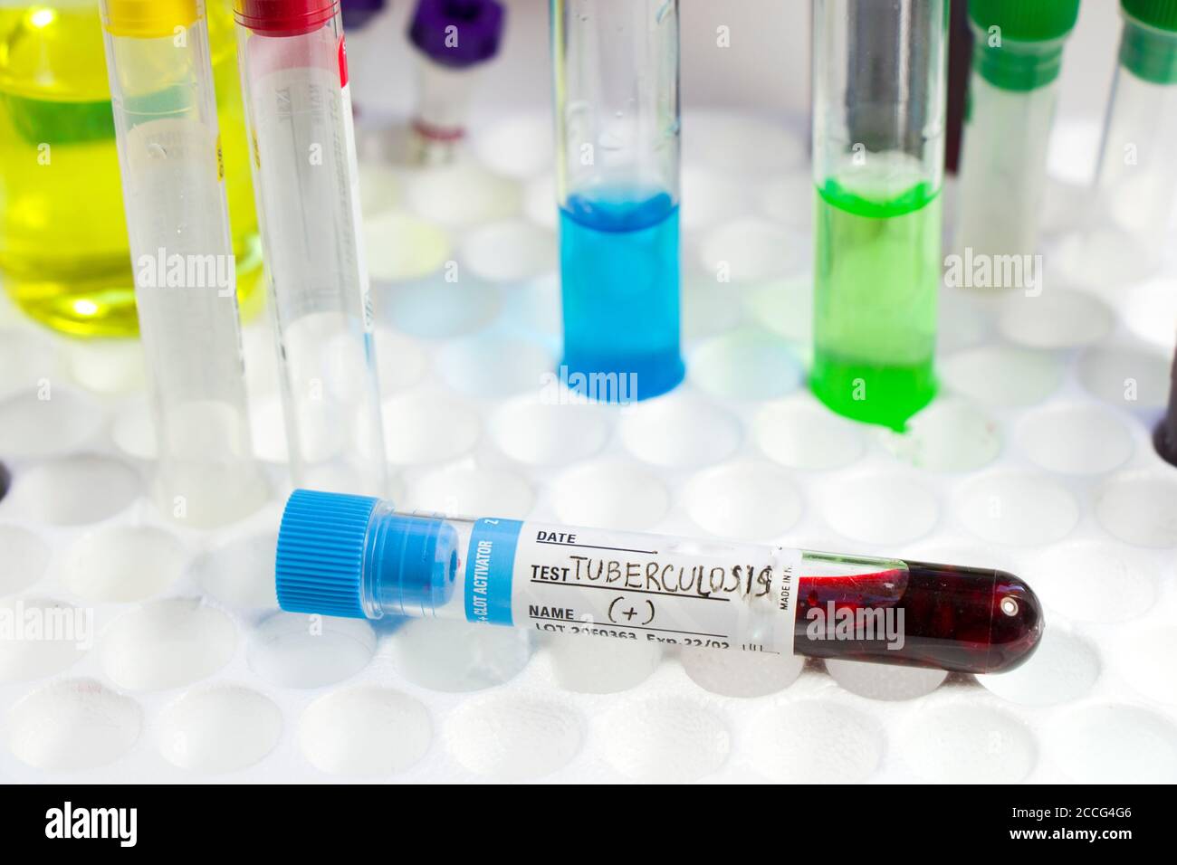 Tuberculosis Treatment High Resolution Stock Photography and Images - Alamy