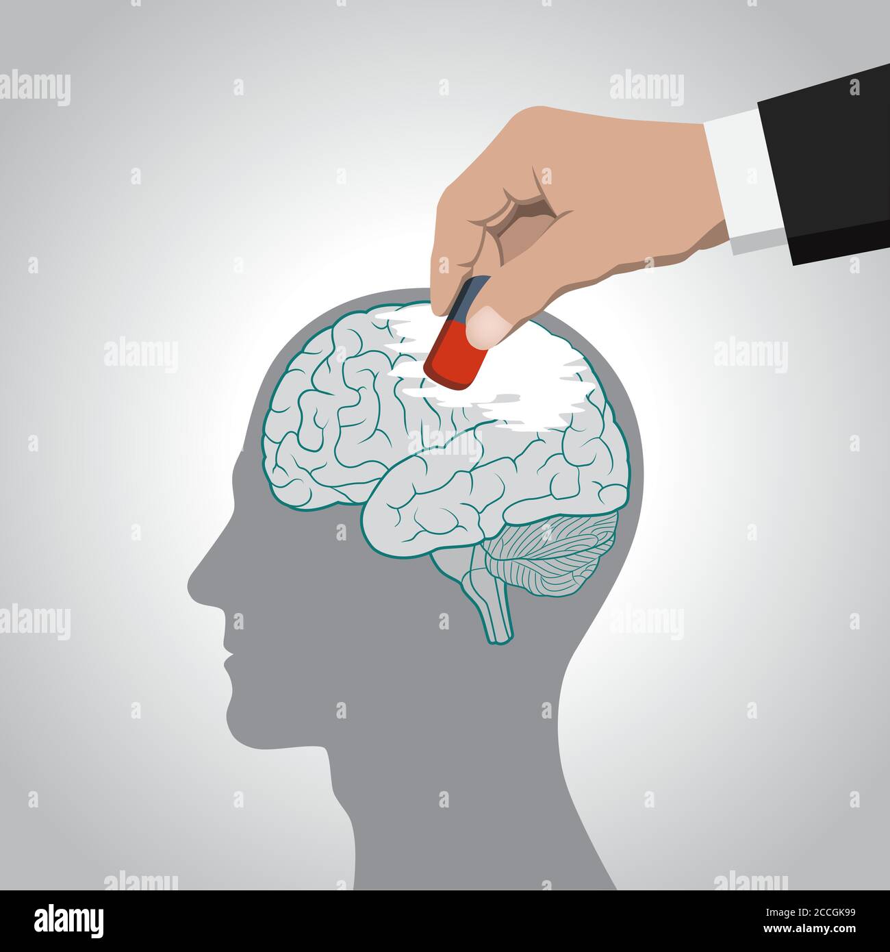 The erasure of the brain, its contents, memory, memories, deprivation ...