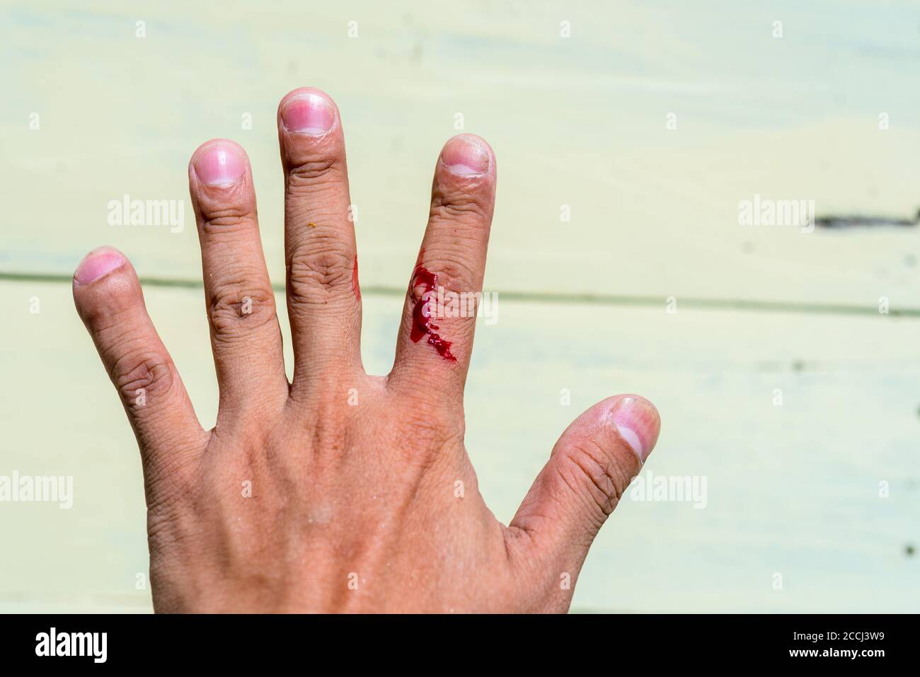 Finger caused hi-res stock photography and images - Alamy