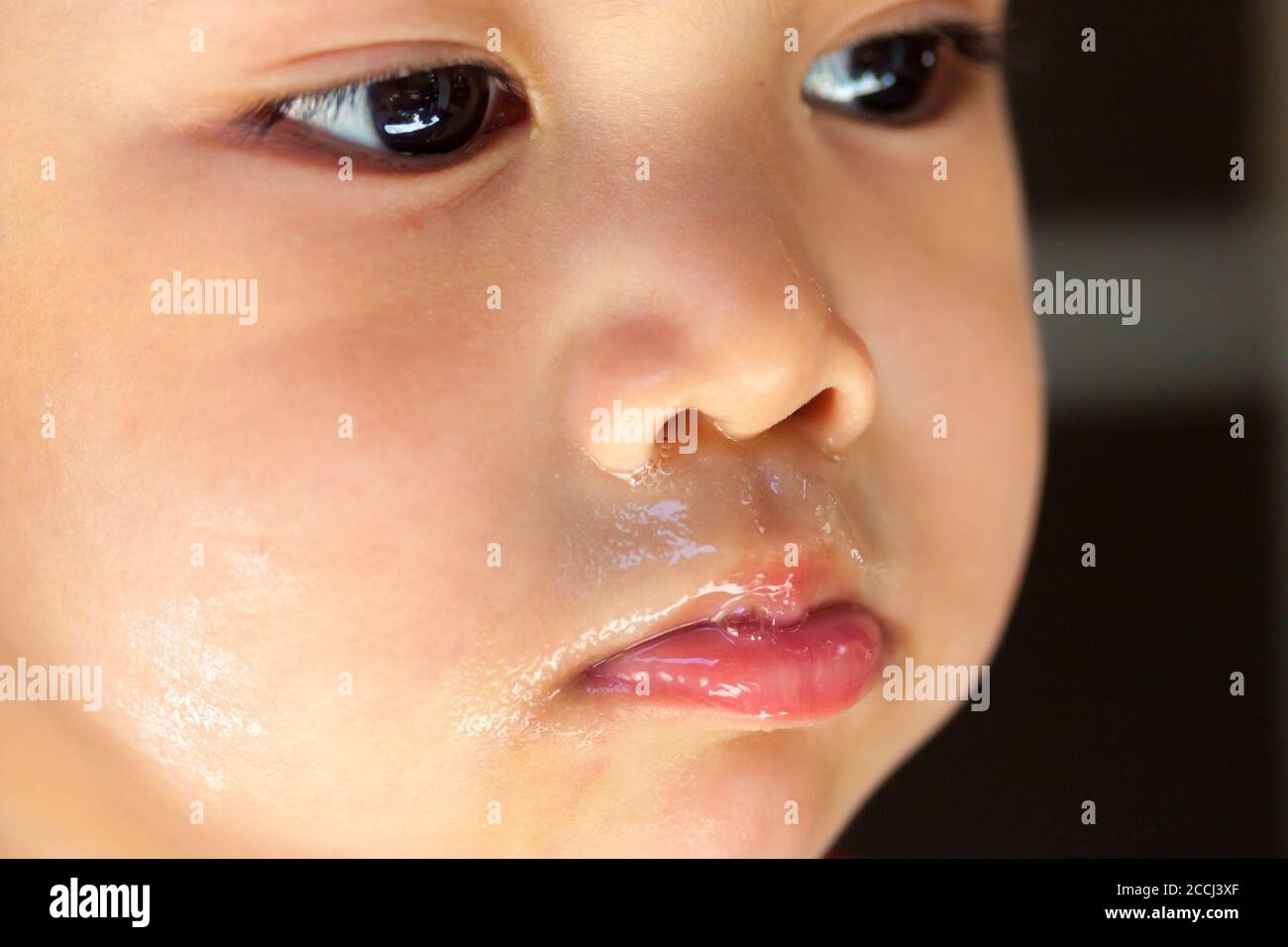 Closeup sickness Asian baby boy face Stock Photo - Alamy
