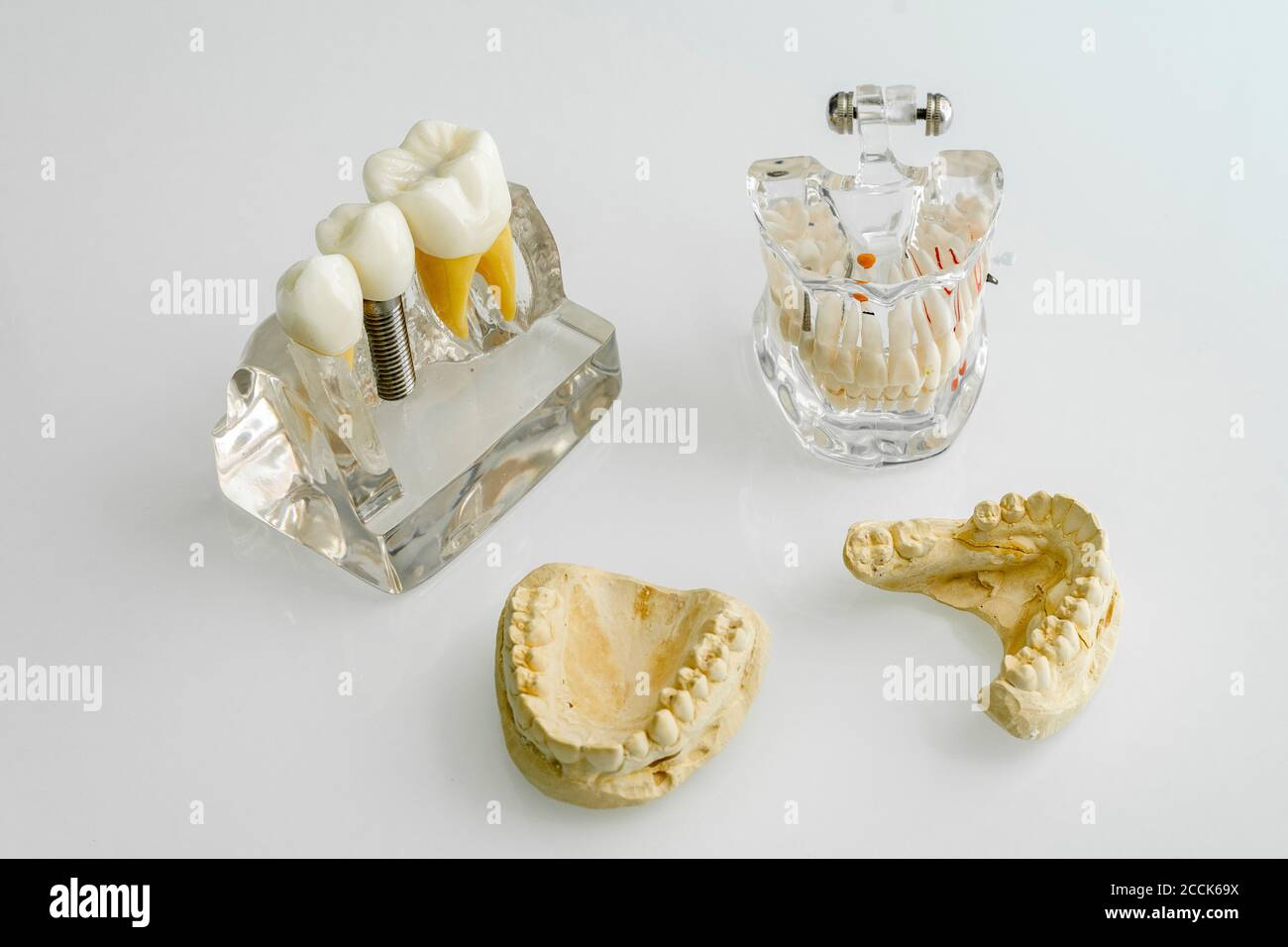 Dentures with human jaw bone on table Stock Photo - Alamy