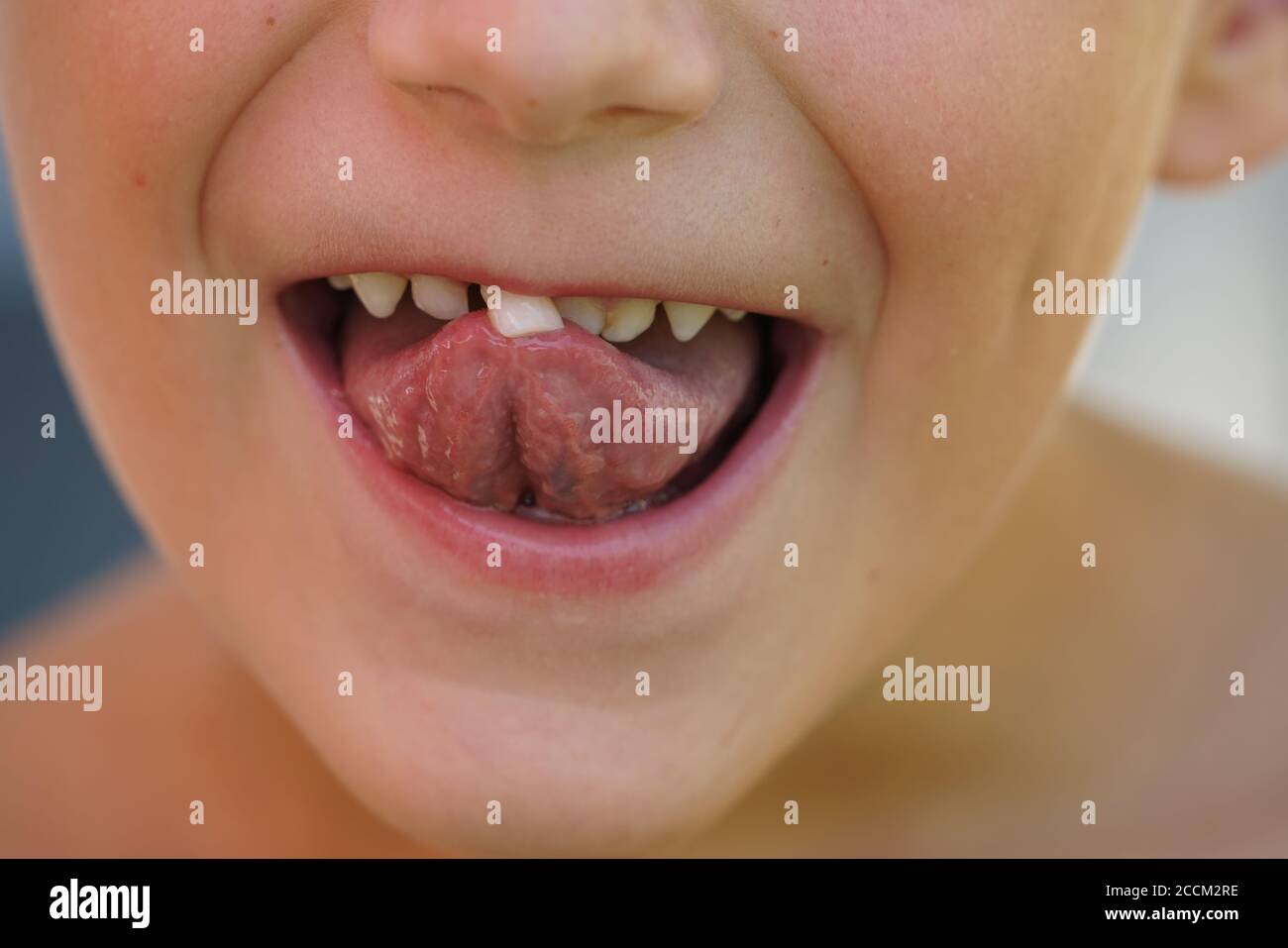a boy using his tongue to help falling a tooth milk Stock Photo - Alamy