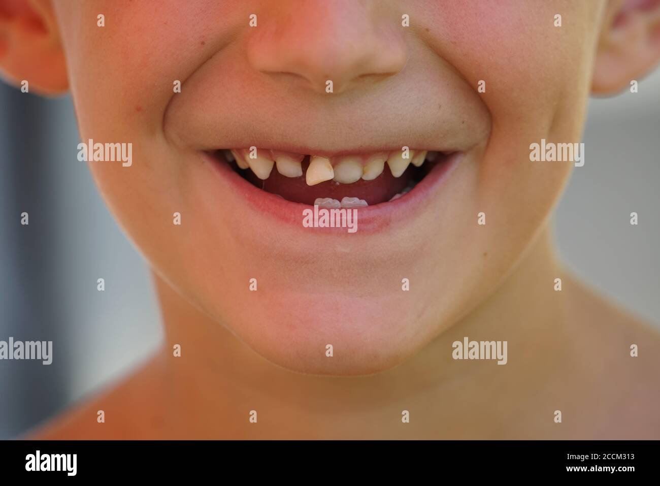 boy smiling open mouth with milk tooth Stock Photo - Alamy
