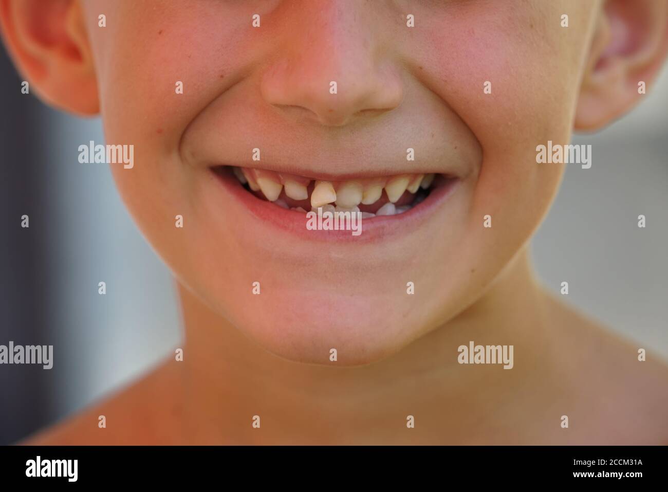 Toothless smiling boy hi-res stock photography and images - Alamy