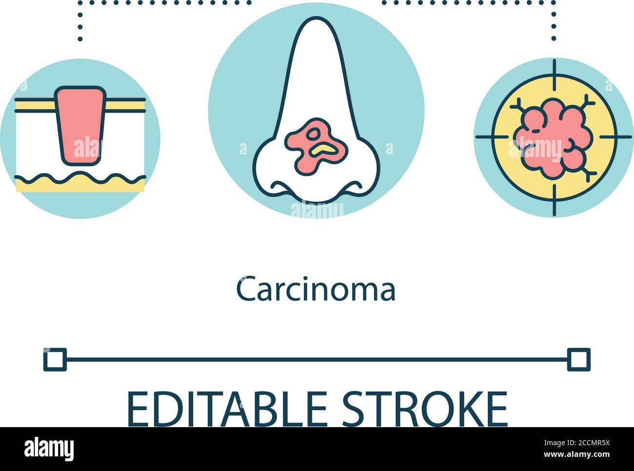 Squamous cell carcinoma drawing Stock Vector Images - Alamy