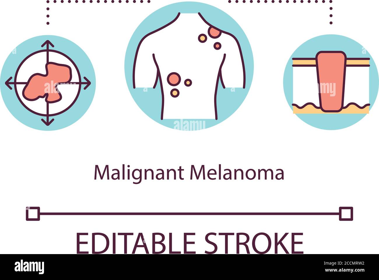 Malignant melanoma concept icon Stock Vector Image & Art - Alamy