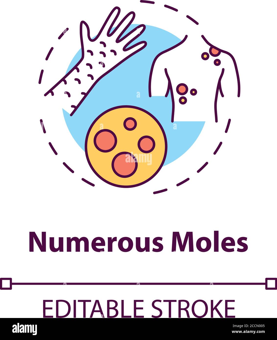 Moles and melanoma Stock Vector Images - Alamy