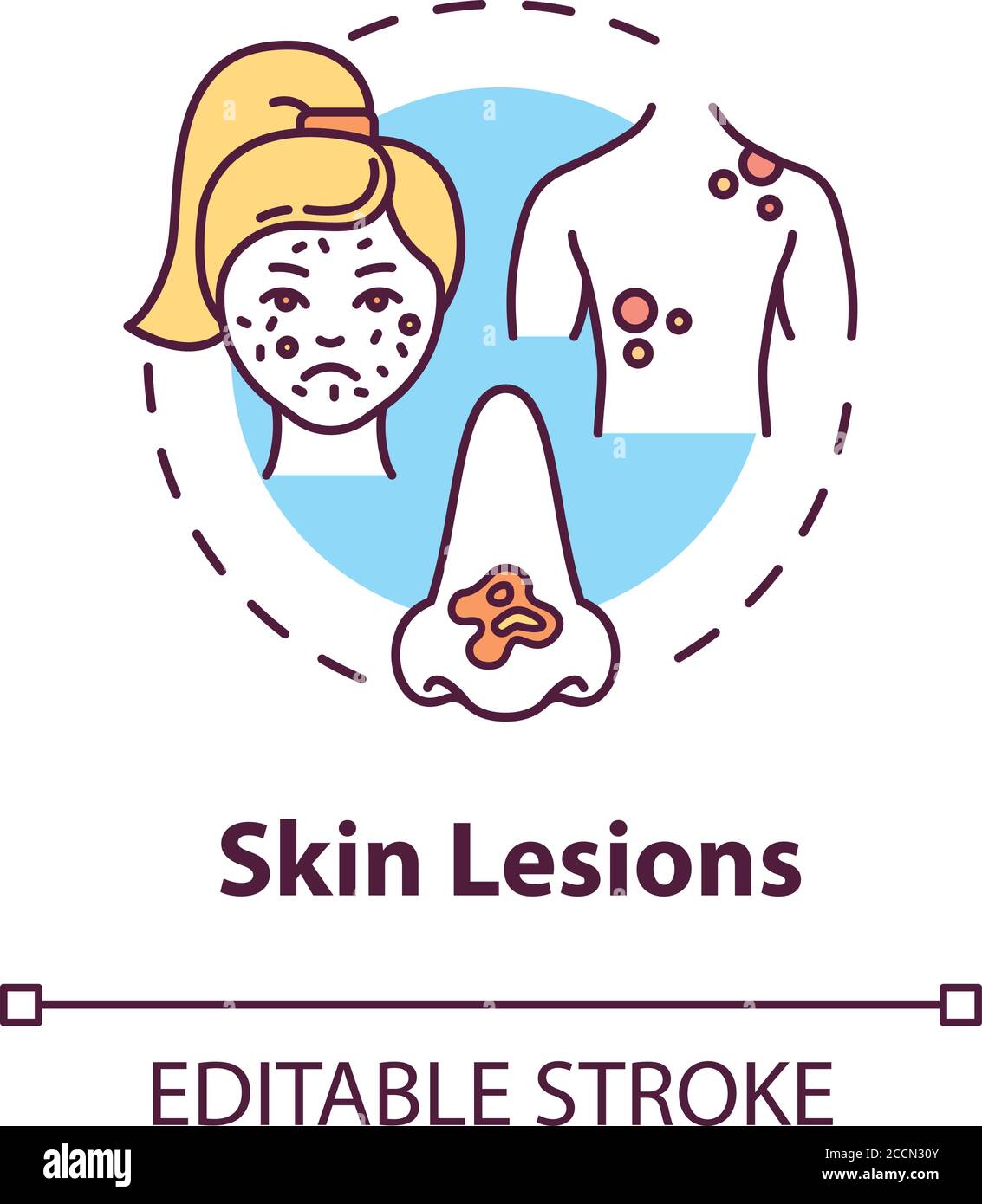 Skin lesions concept icon Stock Vector Image & Art - Alamy