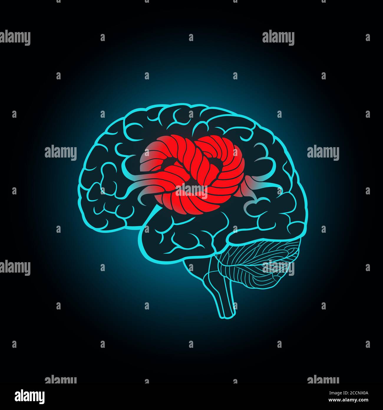 Intractable epilepsy Stock Vector Images - Alamy
