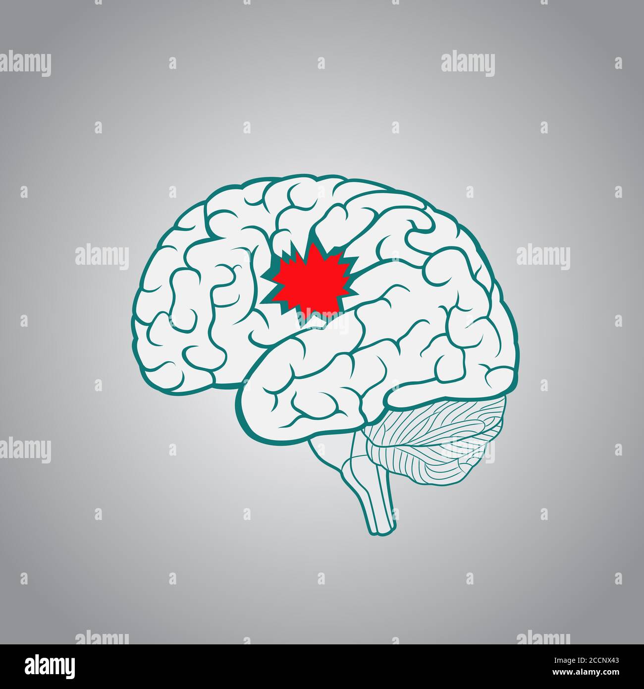 Serious illness and brain injury Stock Vector Image & Art - Alamy