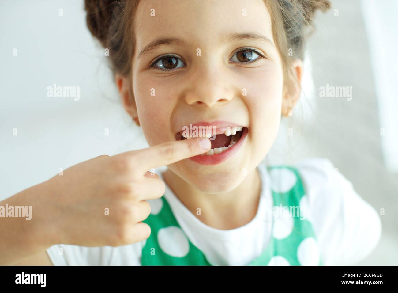 The little girl lost a tooth. Loss of the first tooth in a child Stock ...