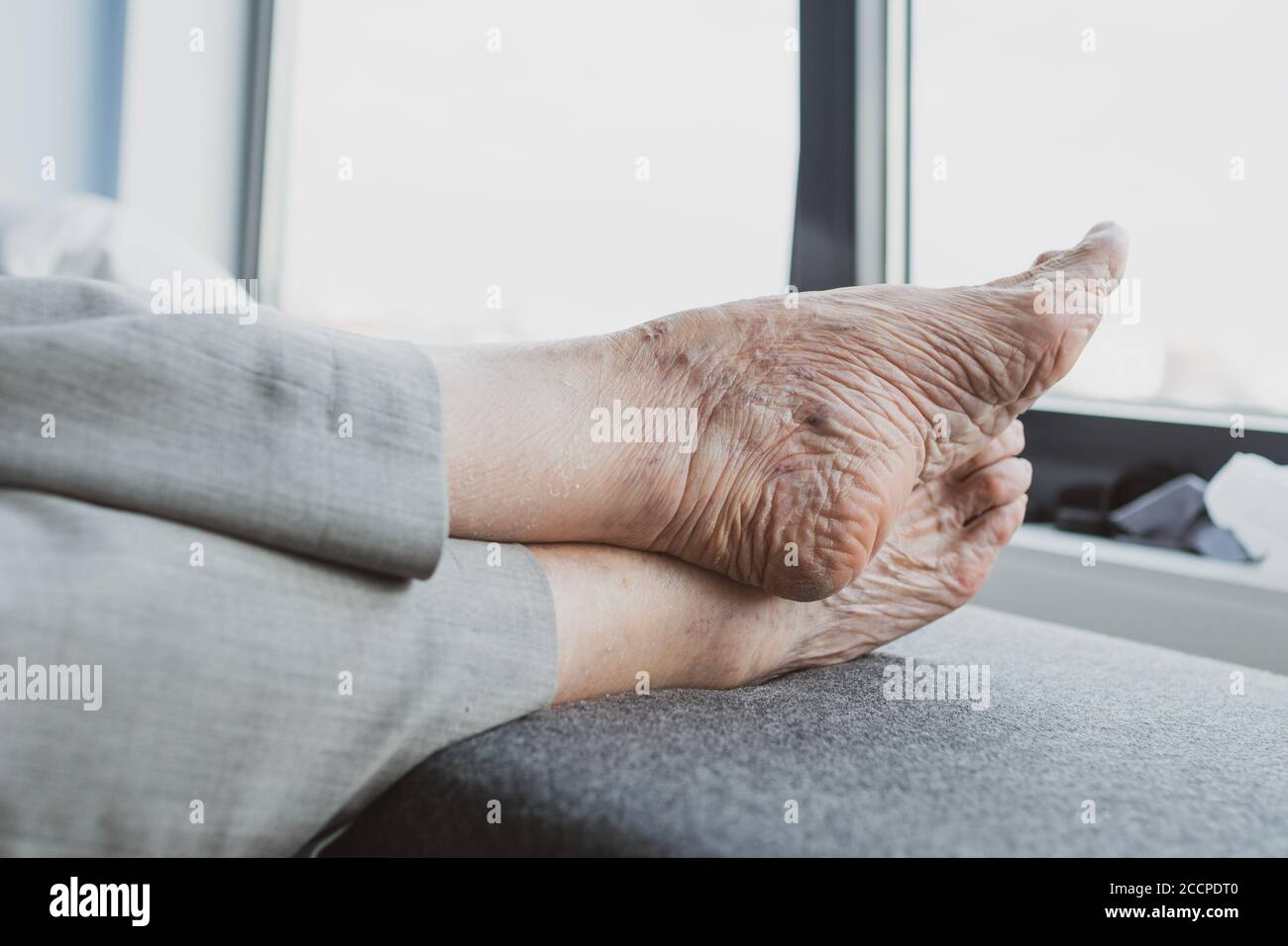 Woman showing her foot hi-res stock photography and images - Alamy