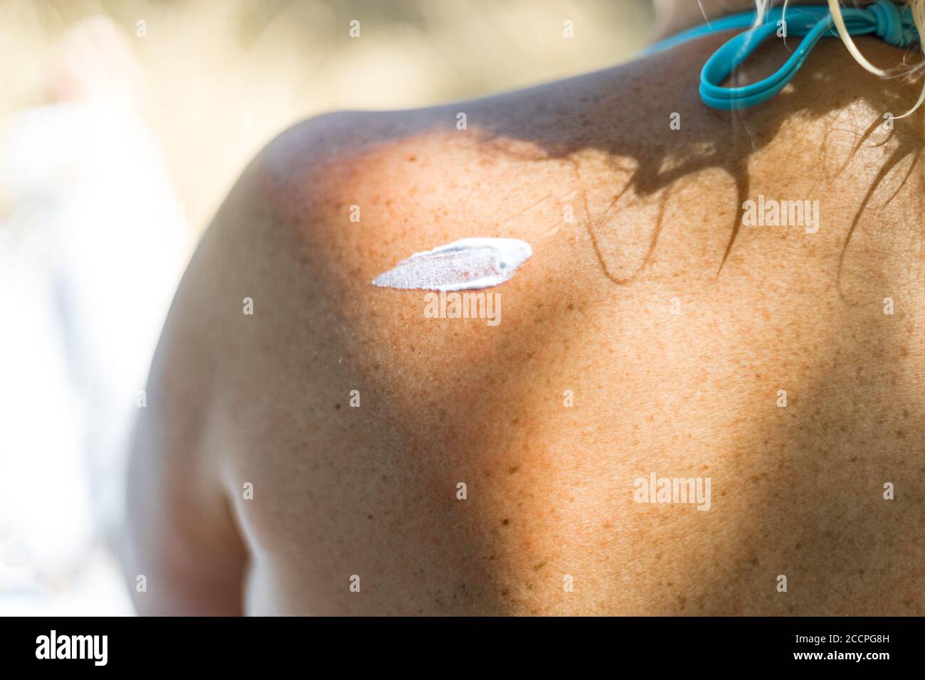 Sunscreen white cream or lotion on the shoulder of the human body. UV ...