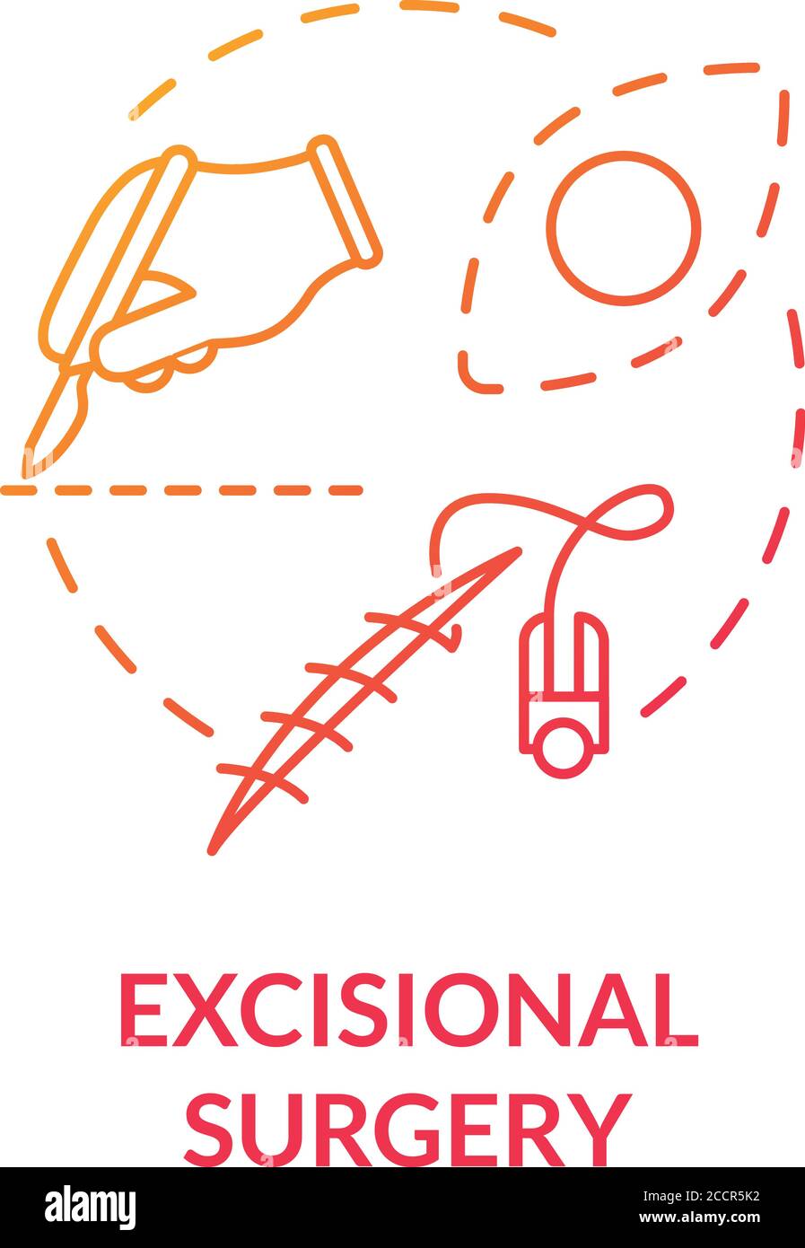 Excisional biopsy Stock Vector Images - Alamy