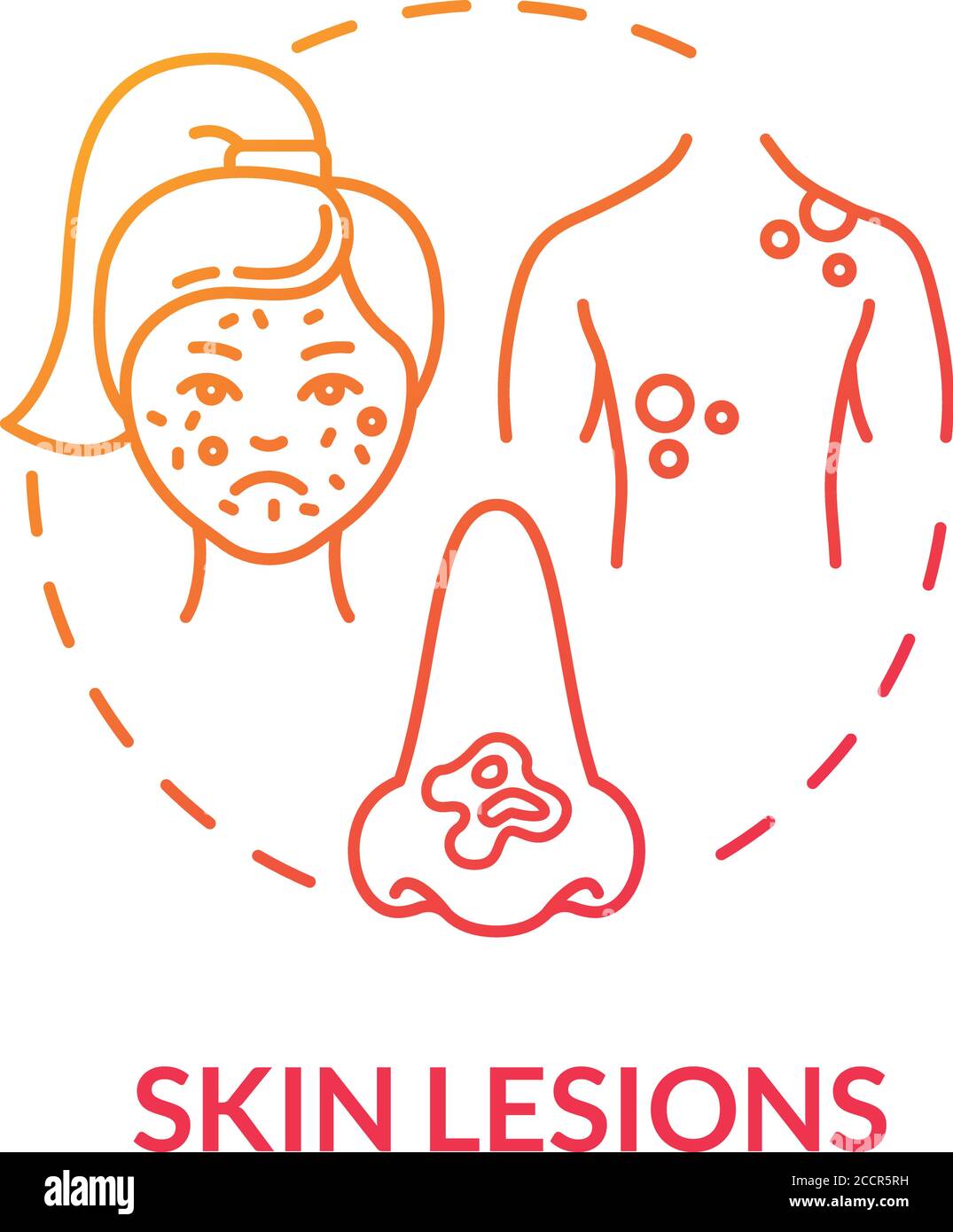 Skin lesions concept icon Stock Vector Image & Art - Alamy
