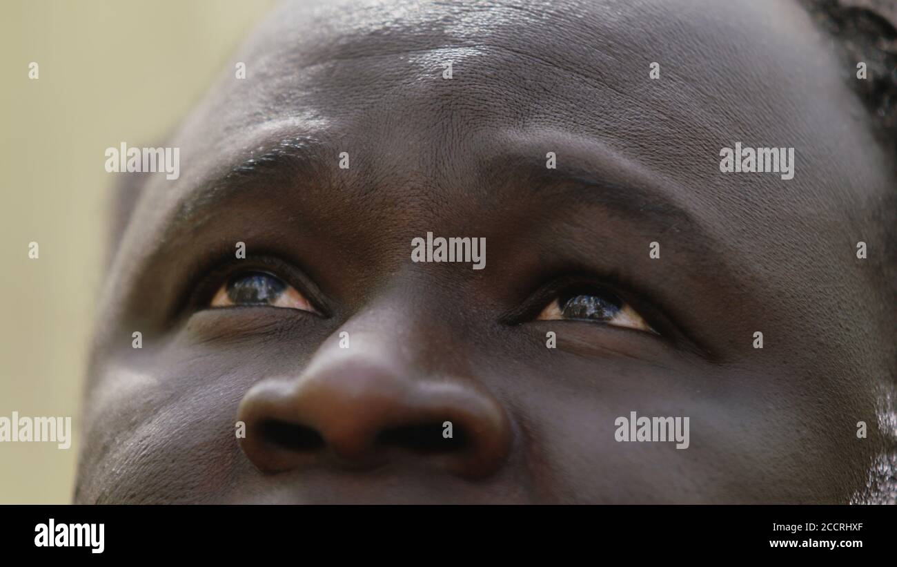 Yellow Sclera African