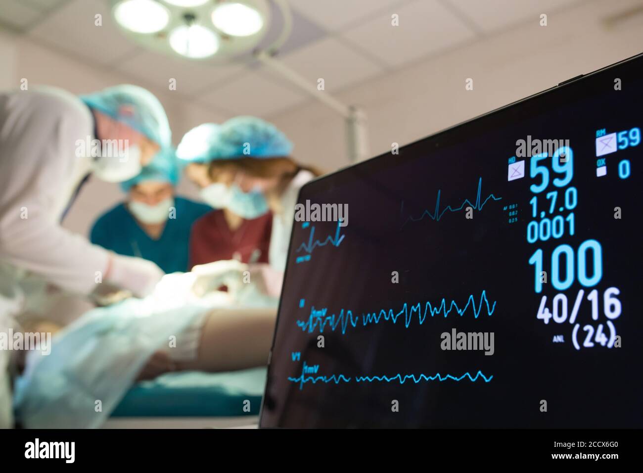 Monitoring of ECG and saturation O2 in the patient in the operating ...