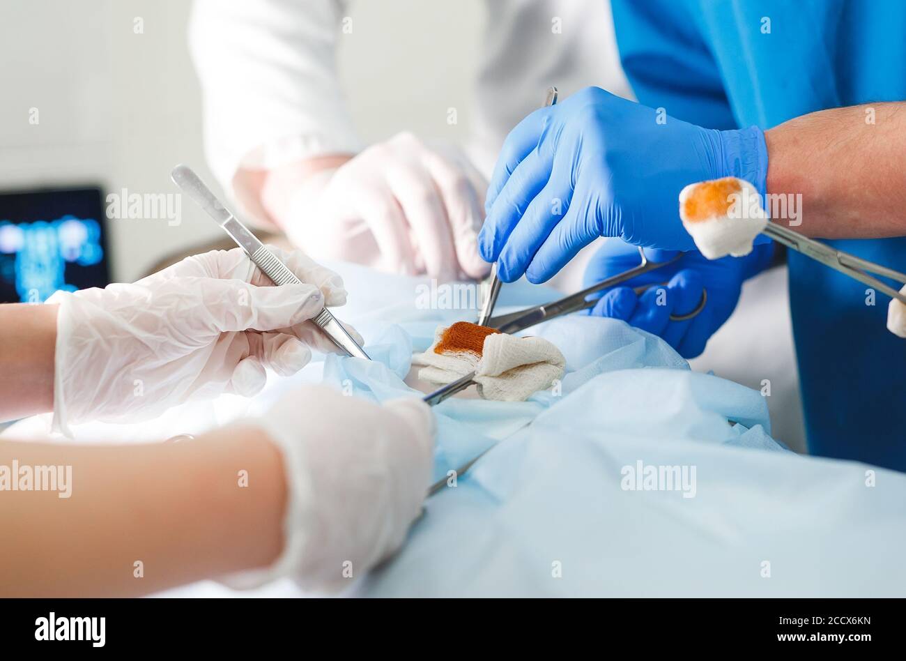 Close up detail of a surgery. Group of surgeons at work operating in ...