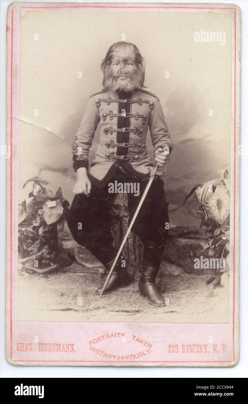 Jo Jo the Dog Faced Boy (2091 Stock Photo - Alamy