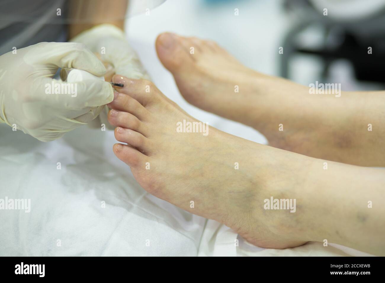 Female foot reflexology hi-res stock photography and images - Alamy