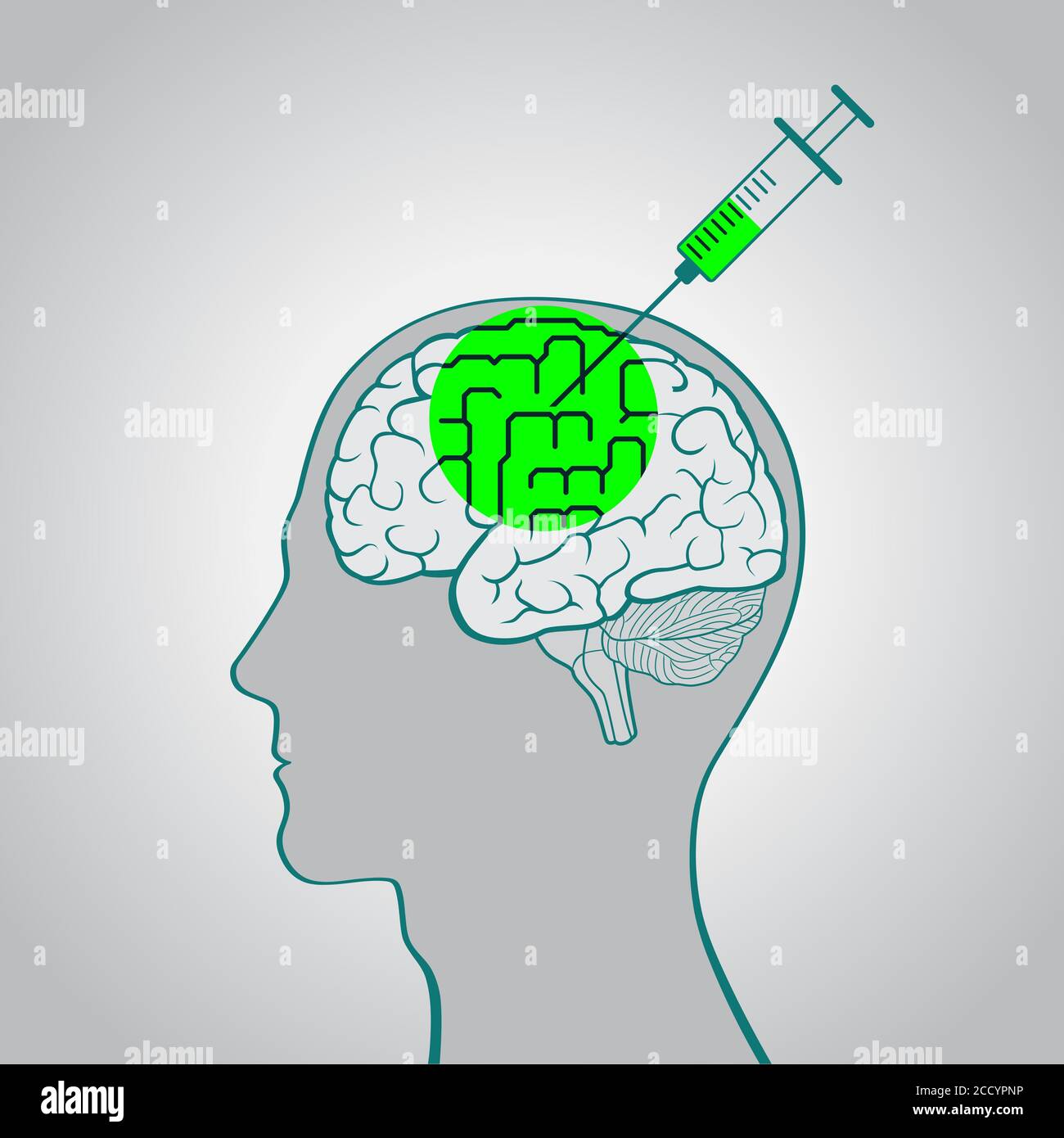 Introducing new information, replacement, adjustment memory. Syringe ...