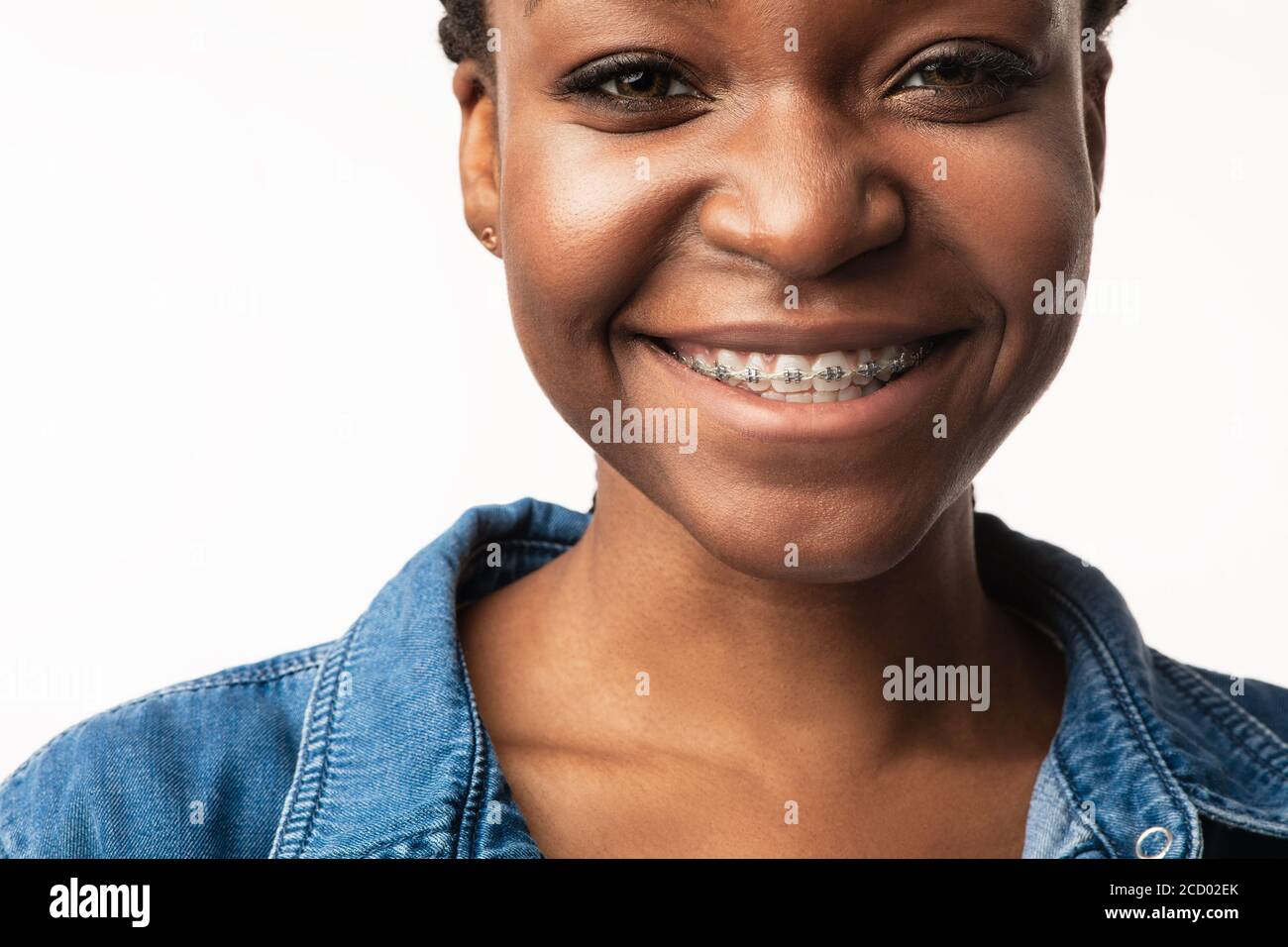 Girl with braces hi-res stock photography and images - Alamy