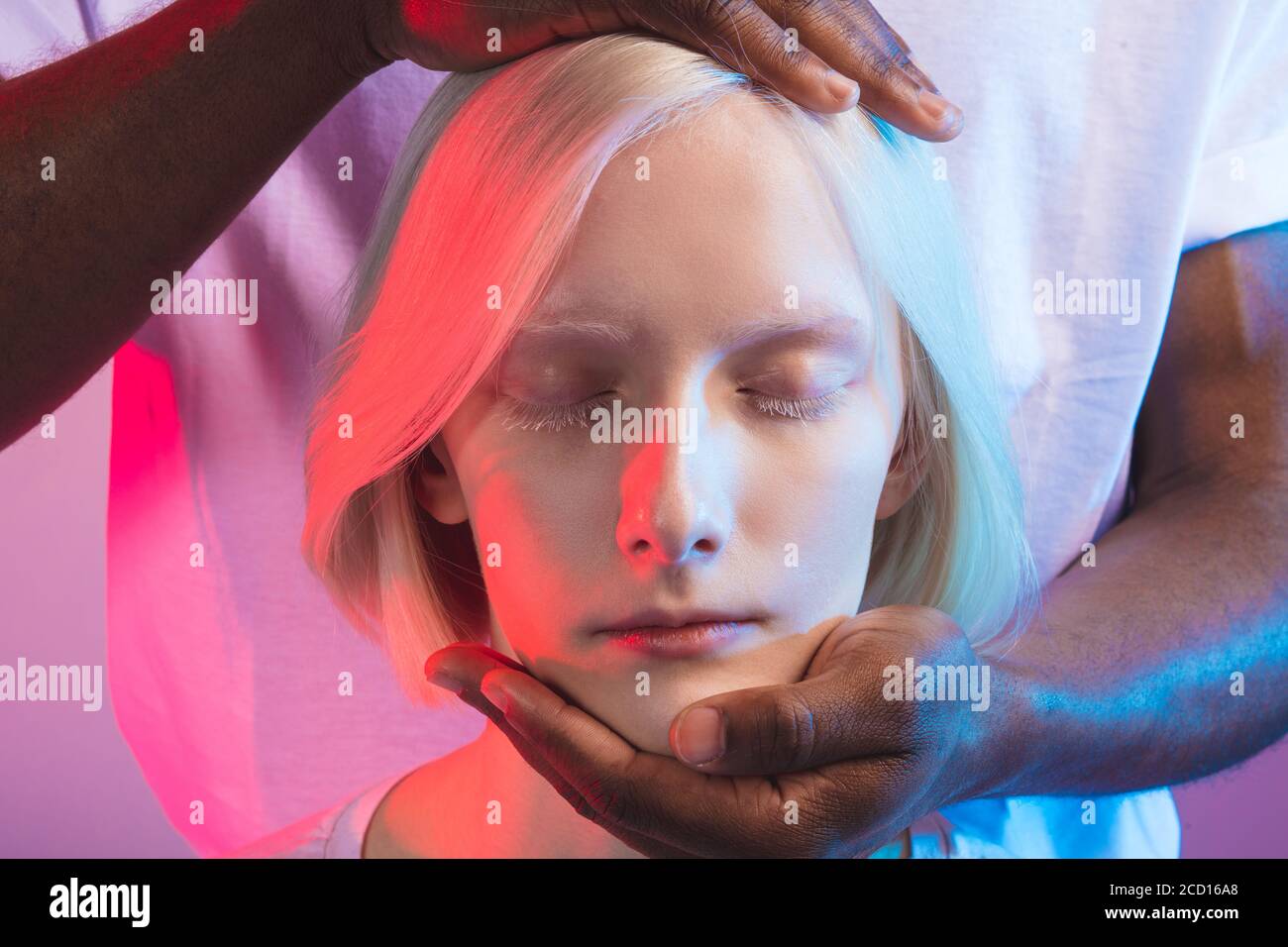 albino girl with white eyelashes getting medical treatment. hypnosis ...