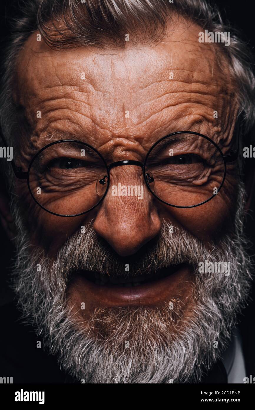 Wrinkled Forehead Angry