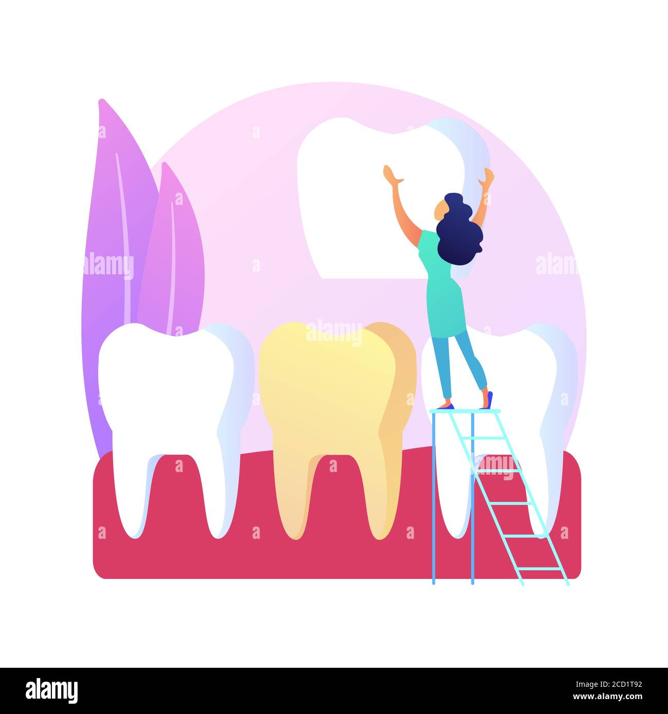 Dental veneers abstract concept vector illustration Stock Vector Image ...