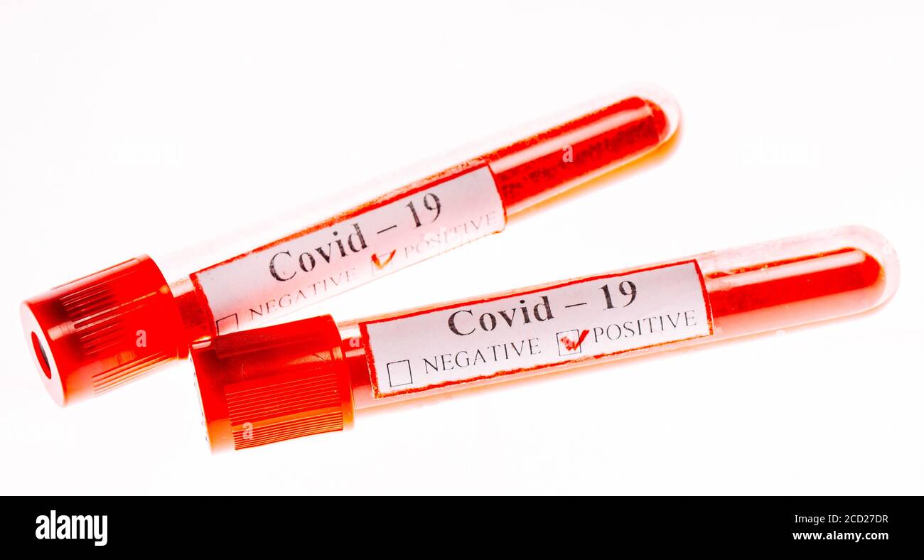 Positive blood Tests for Coronavirus in test tubes Stock Photo - Alamy